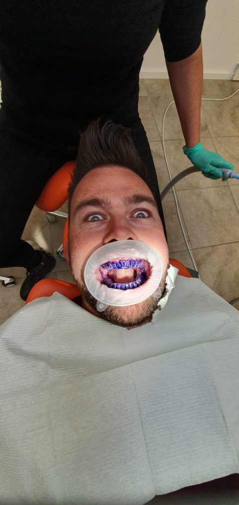 EMS AIRFLOW® PROPHYLAXIS MASTER | Larix Dental Concepts